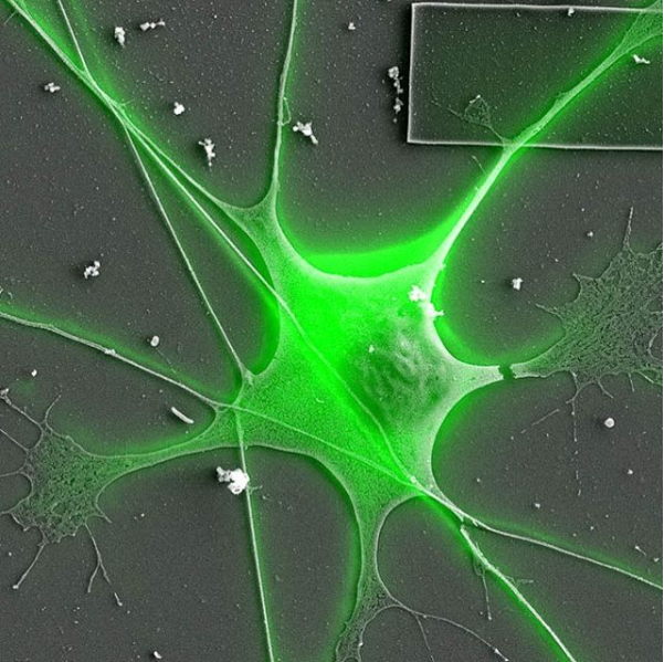 Image Gallery – Chesapeake Microscopy and Microanalysis Society